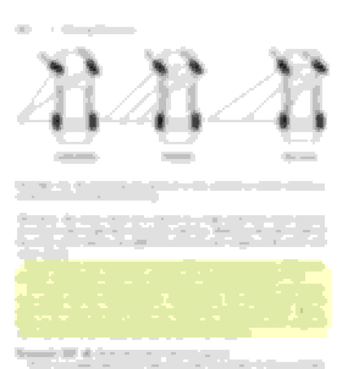 Ackerman effect on C8? - CorvetteForum - Chevrolet Corvette Forum ...